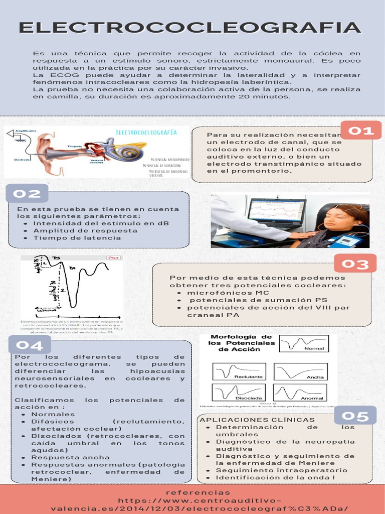 Electrococleografia ECOG | PDF