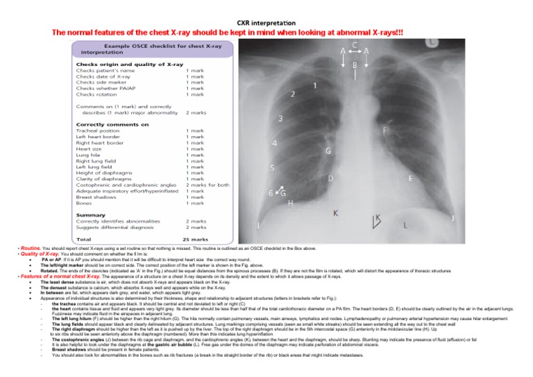Cxr Interpretation Checklist Short Pdf Lung Thorax