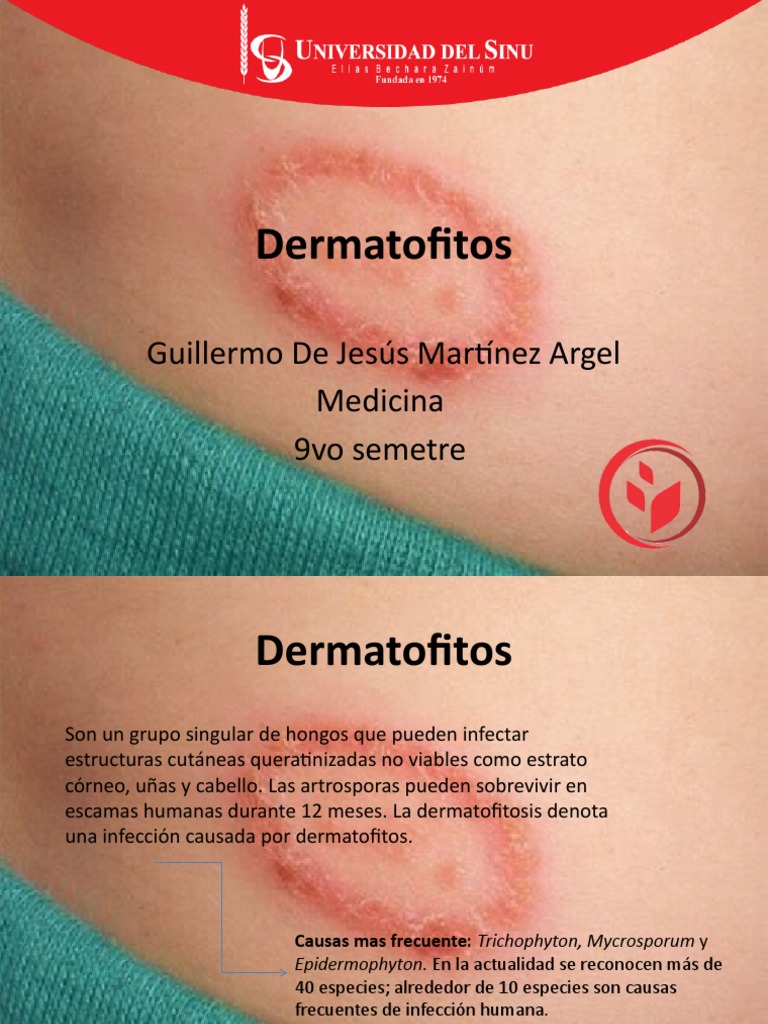 Dermatofitos: Causas, Tipos y Tratamientos | PDF | Hogar, jardinería y ...