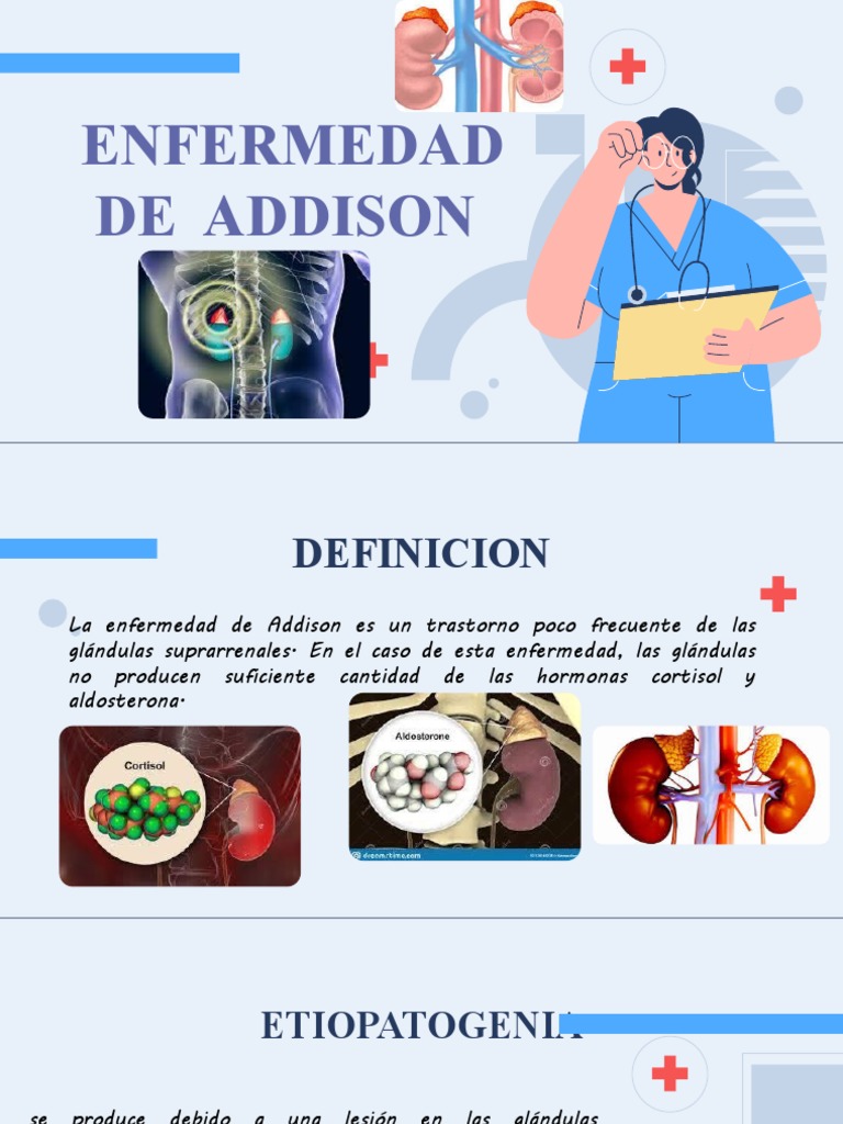 Enfermedad de Addison: Definición y Síntomas | PDF