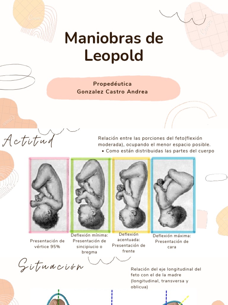 Maniobras de Leopold | PDF
