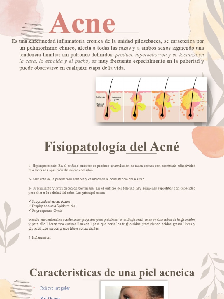 Acne | PDF