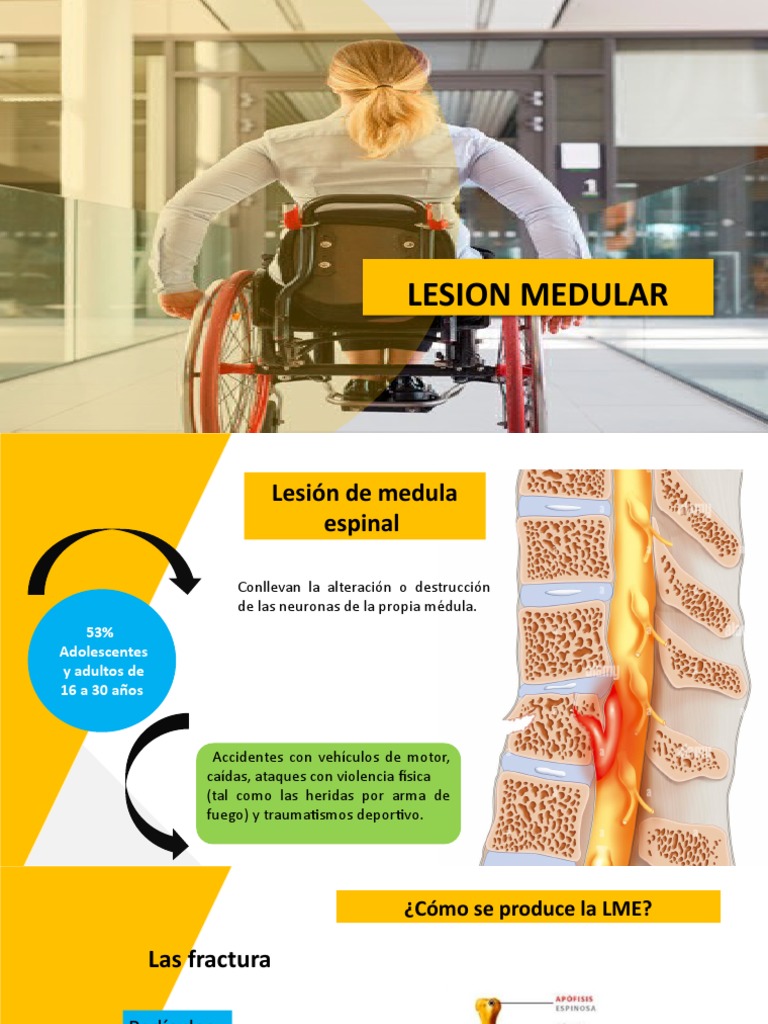 Lesion Medular | PDF | Lesión | Lesión de la médula espinal