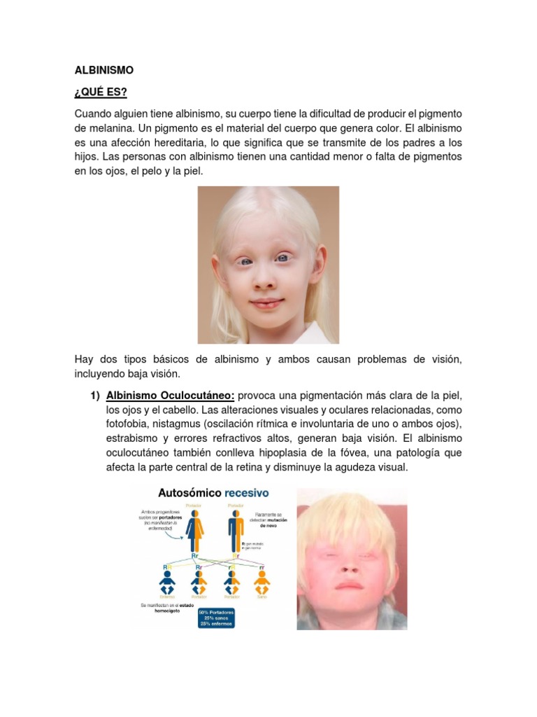 ALBINISMO | PDF | Ojo humano | Percepción visual