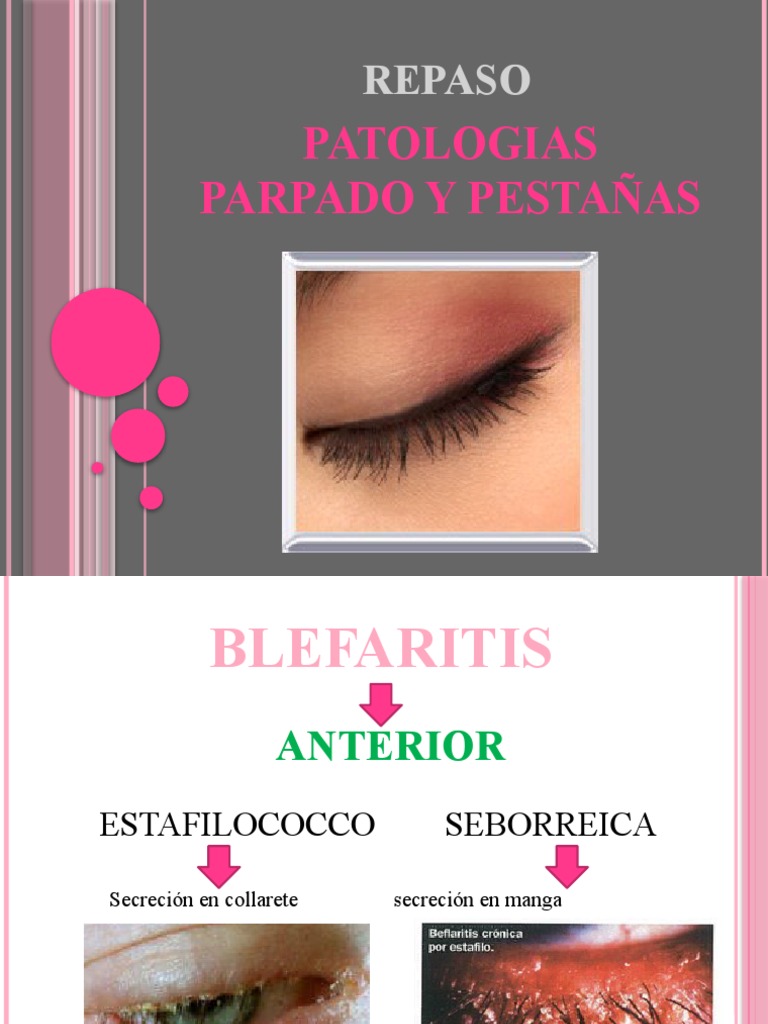 Patologia de Parpado | PDF