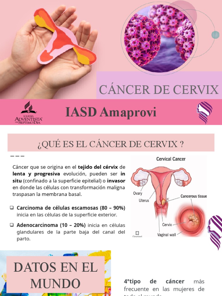 Cancer de Cervix | PDF