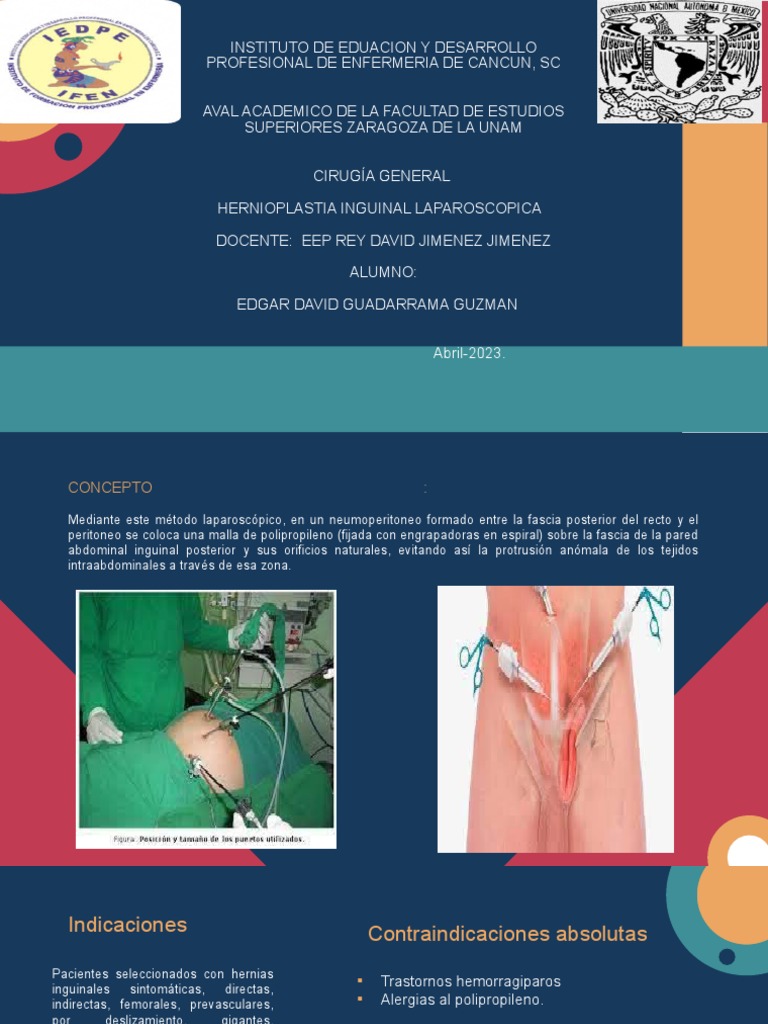 Hernioplastia Inguinal Laparoscopica | PDF