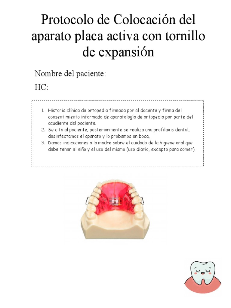 Colocación de placa activa con tornillo de expansión: Protocolo para ...