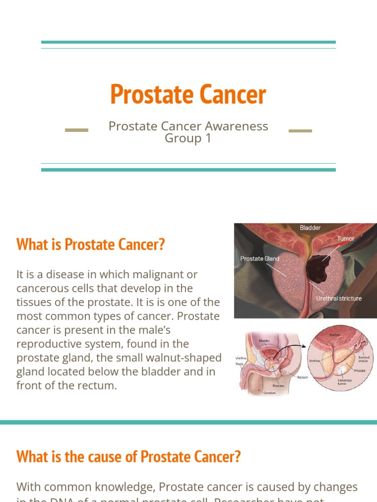 Prostate Cancer Awareness Guide | PDF | Wellness