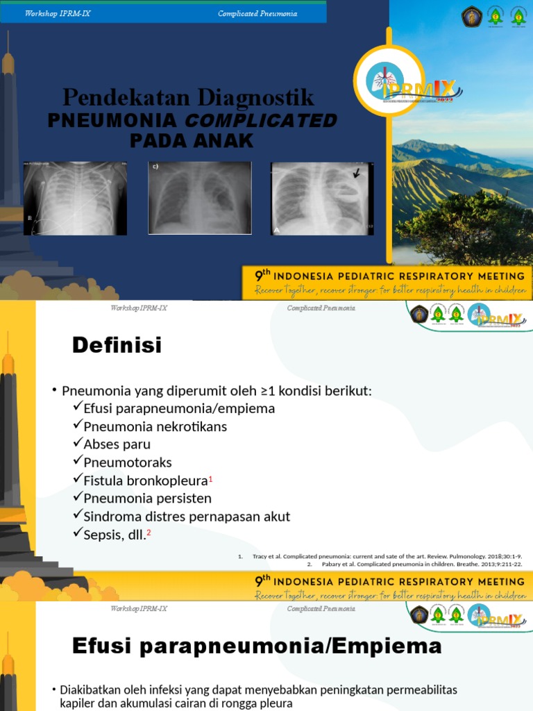 IPRM Workshop Complicated Pneumonia PPT Template | PDF