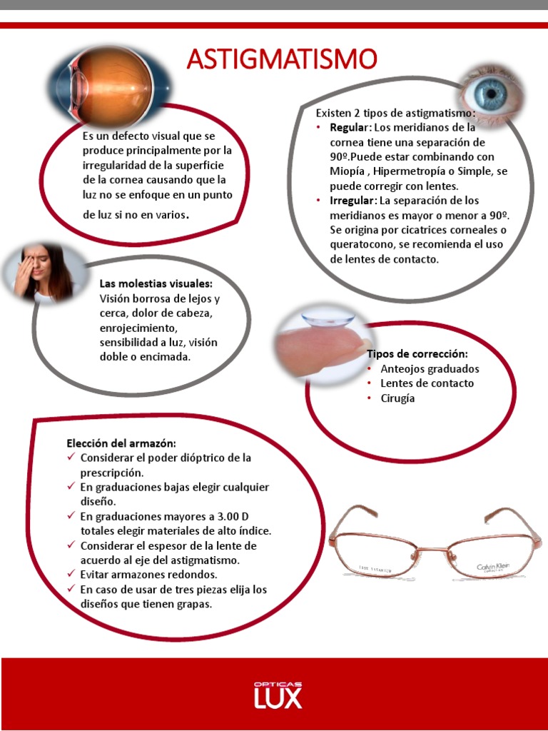 Infografia Astigmatismo | PDF