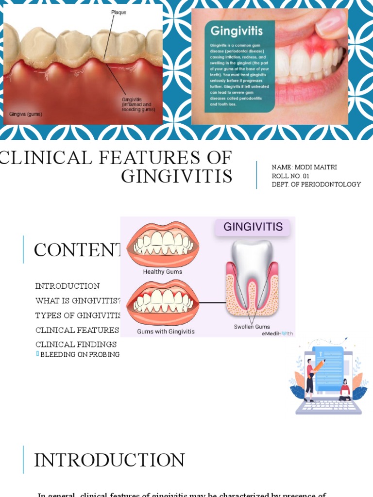 Clinical Features of Gingivitis 1 | PDF