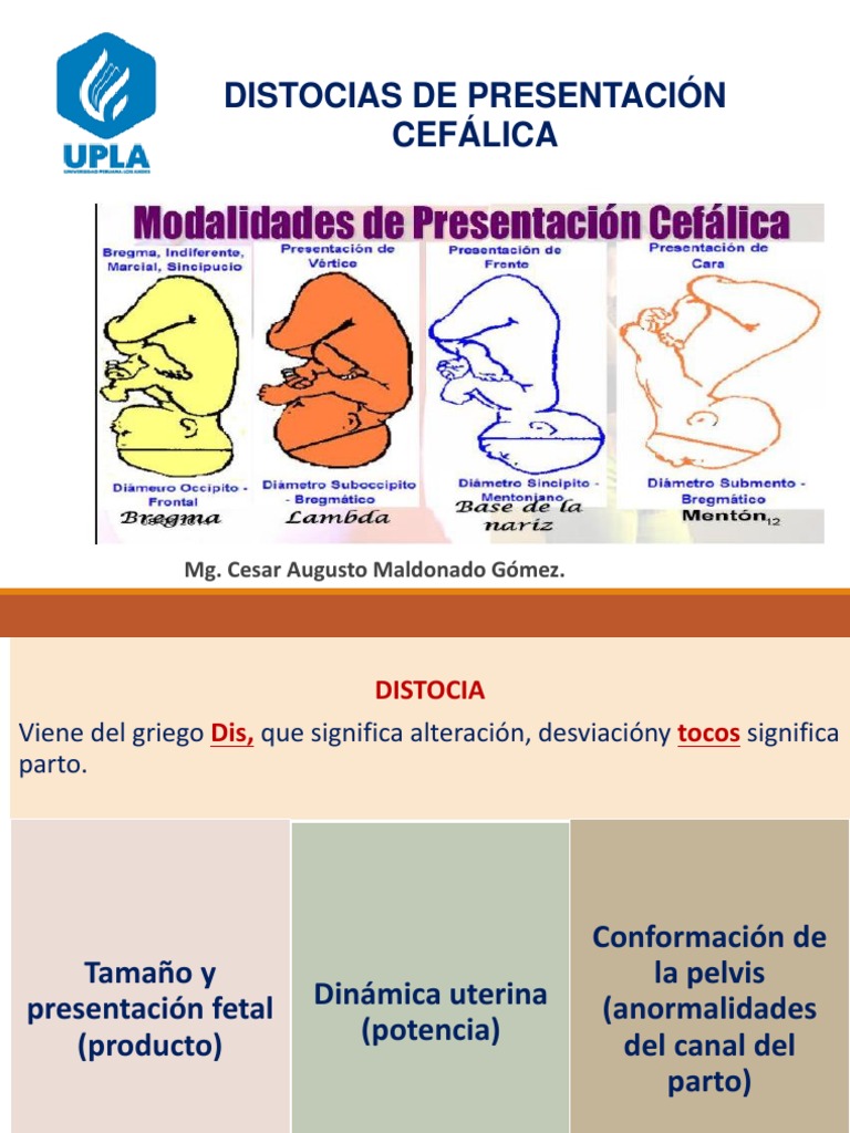 Distocia de Presentación Cefálica | PDF | Parto | Especialidades Medicas
