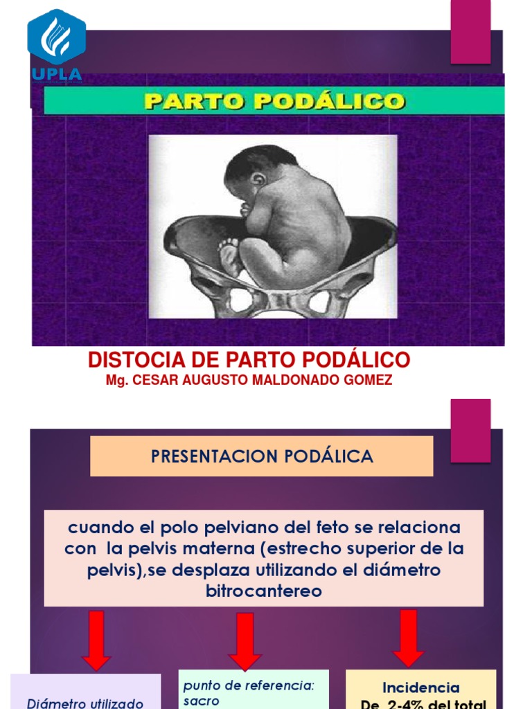 Distocias de Presenación (Parto Podálico) | PDF | Parto | Feto