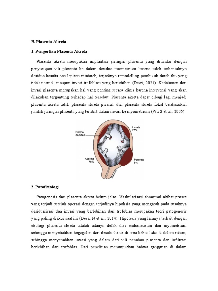 Plasenta Akreta | PDF