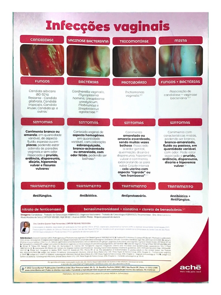 Infecções Vaginais | PDF