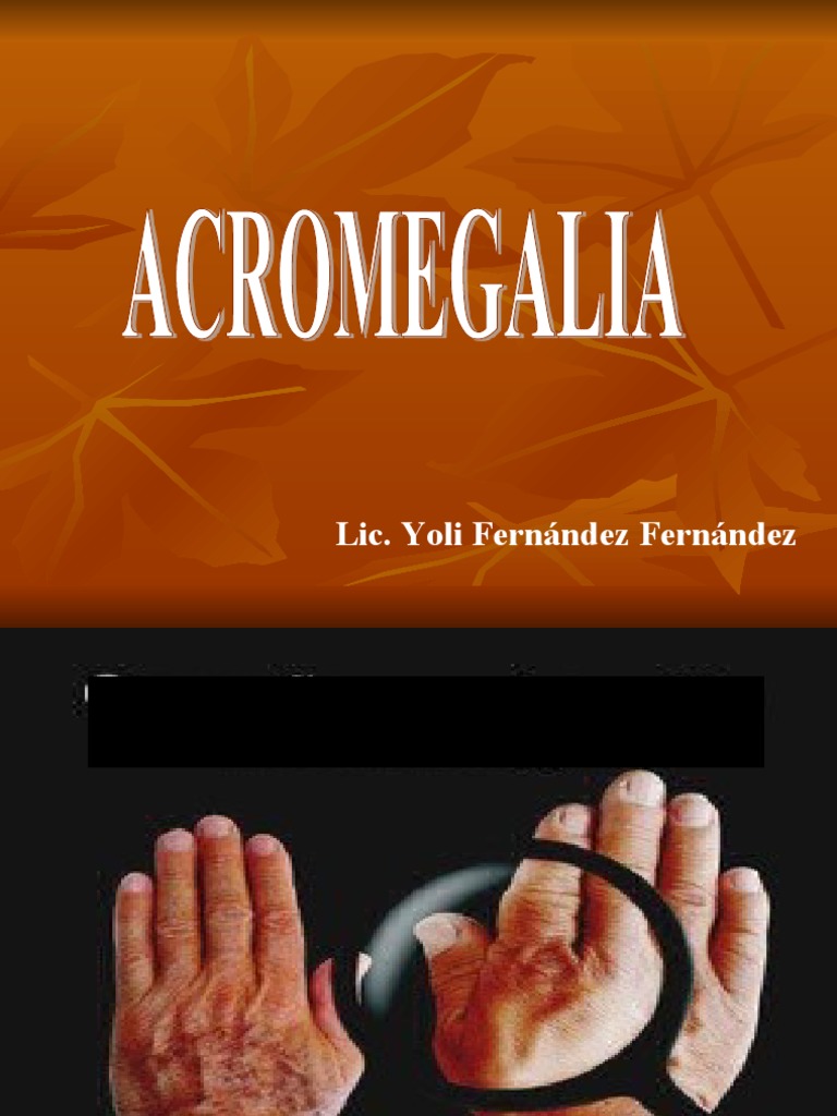 Acromegalia: Síntomas y Diagnóstico | PDF | Medicina CLINICA ...