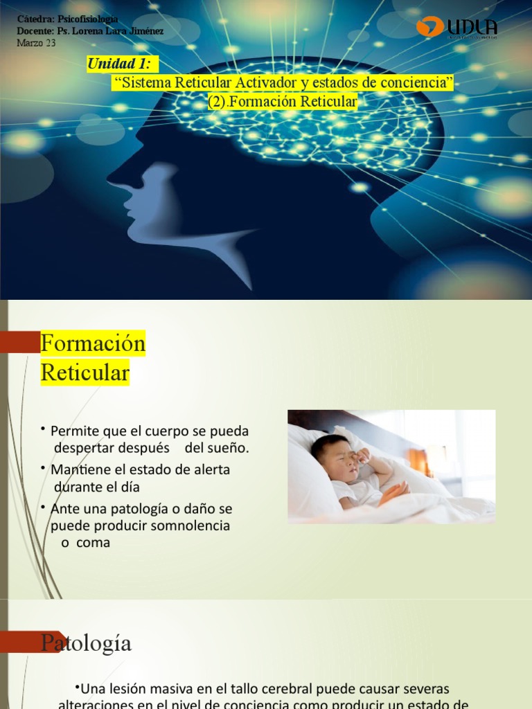 Clase 2 Unidad 1 Formación Reticular Pdf Cerebro Sistema Nervioso
