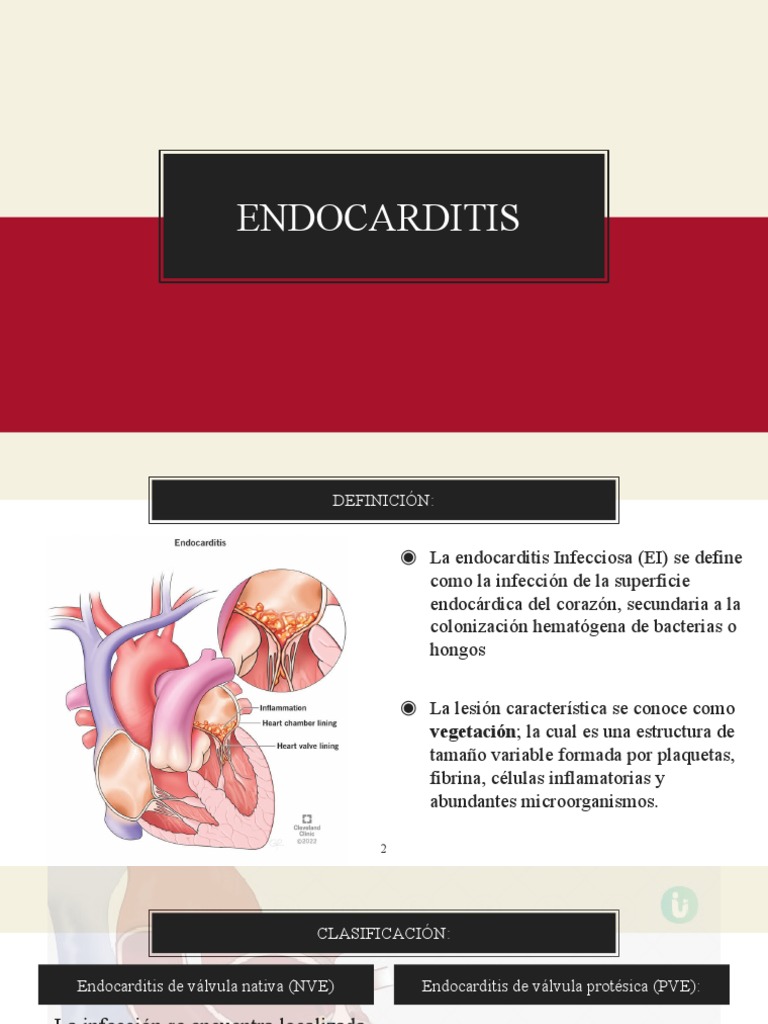 Endocarditis, Miocarditis, Pericarditis, TBP y Fiebre Reumatica | PDF ...
