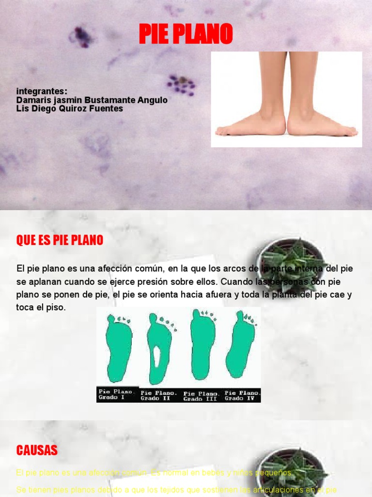 Tratamiento y diagnóstico del pie plano | PDF | Pie | Terapia física