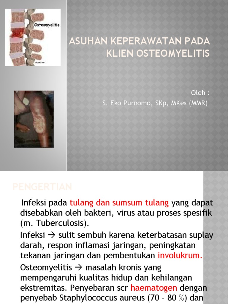 Askep Osteomyelitis | PDF