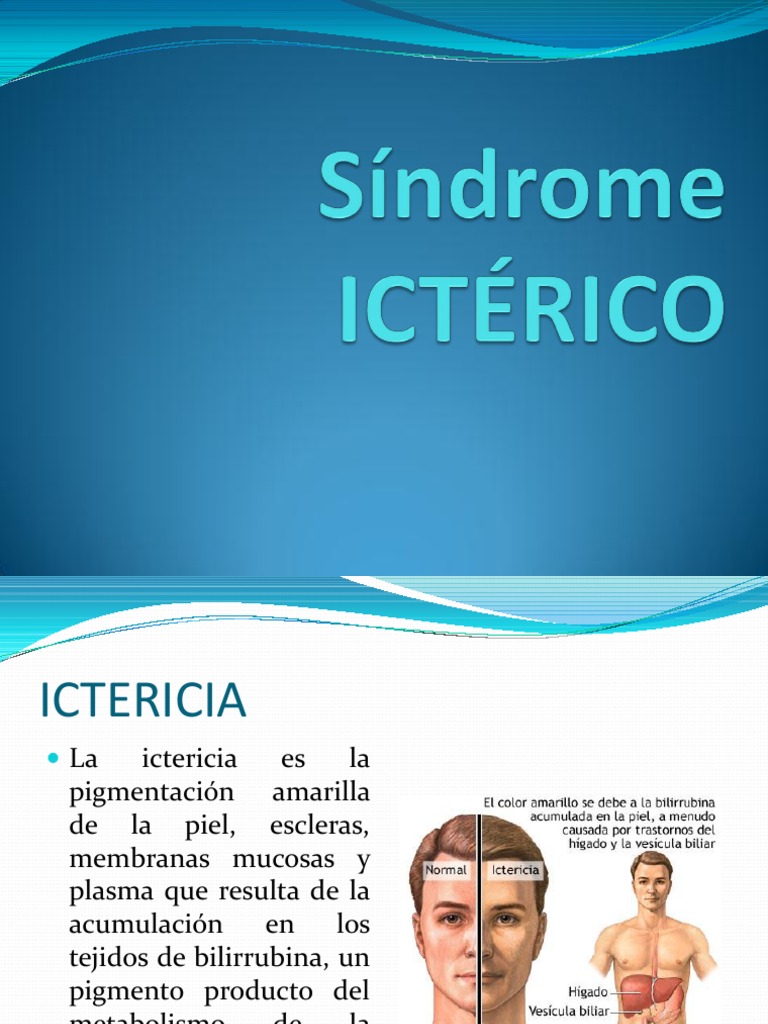 Síndrome Icterico | PDF | Hepatitis | Hígado