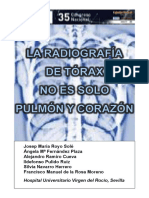 Signos radiológicos del hilio pulmonar | PDF | Pulmón | Corazón