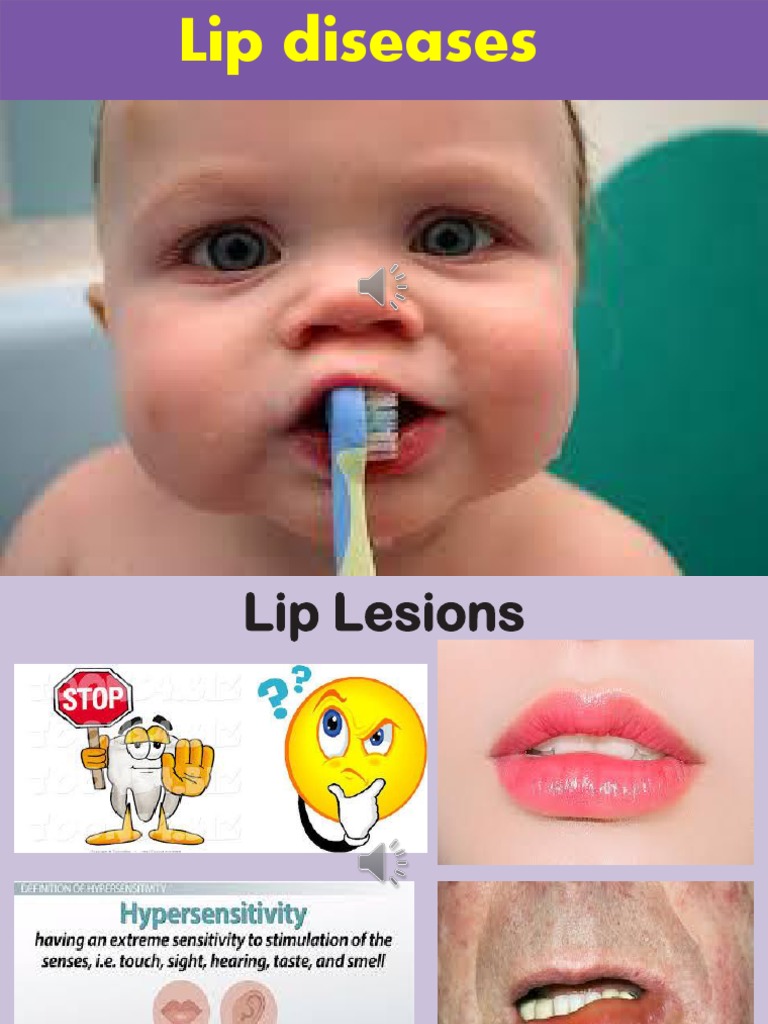 Lip Diseases | Download Free PDF | Diseases And Disorders | Medical ...