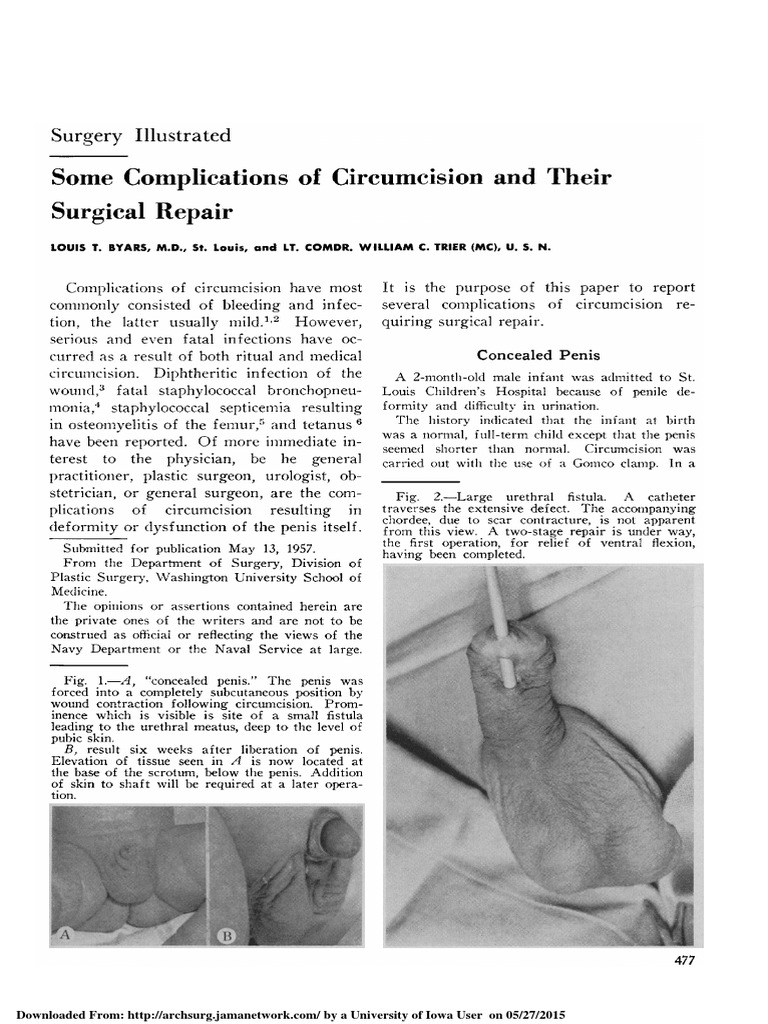 Byars 1958 | PDF | Circumcision | Penis