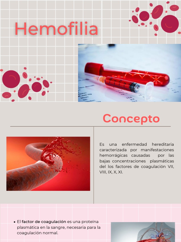 Hemofilia | PDF | Hemofilia | Coagulación