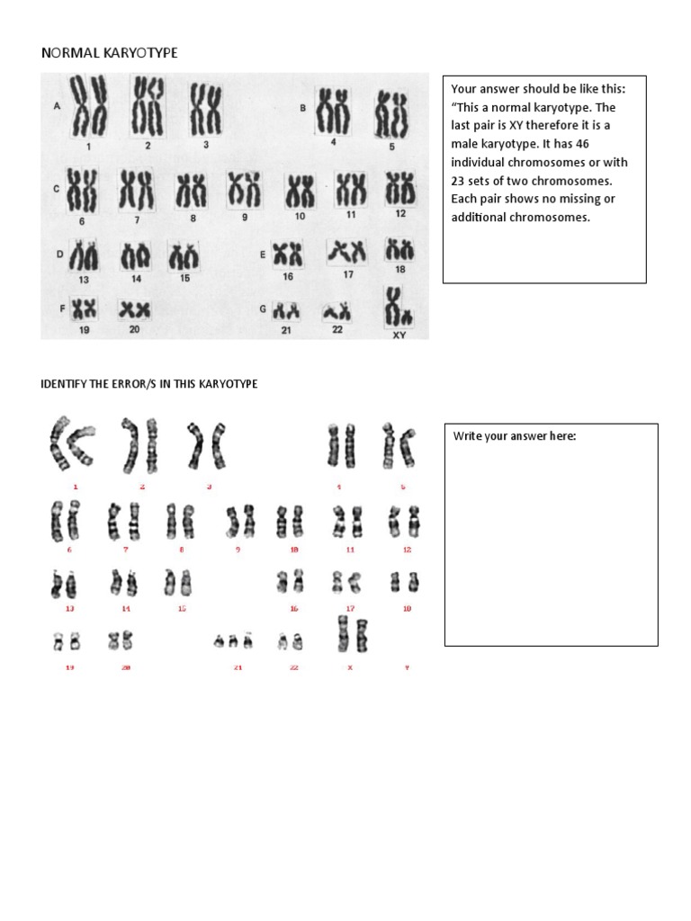 Normal Karyotype | PDF