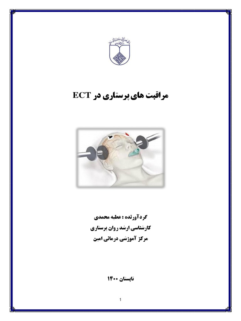 ECT | PDF