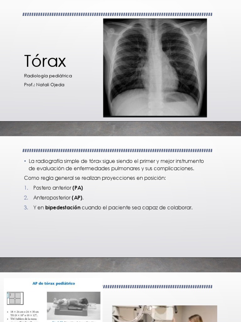 Tórax | PDF | Tórax | Anatomía