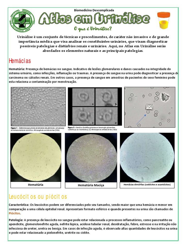 Atlas de Urinálise (1) | PDF | Glóbulo branco | Infecção do trato urinário