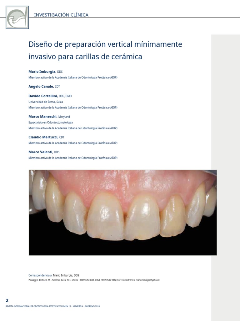 Minimally Invasive Vertical Preparation Design For Ceramic Veneers ...