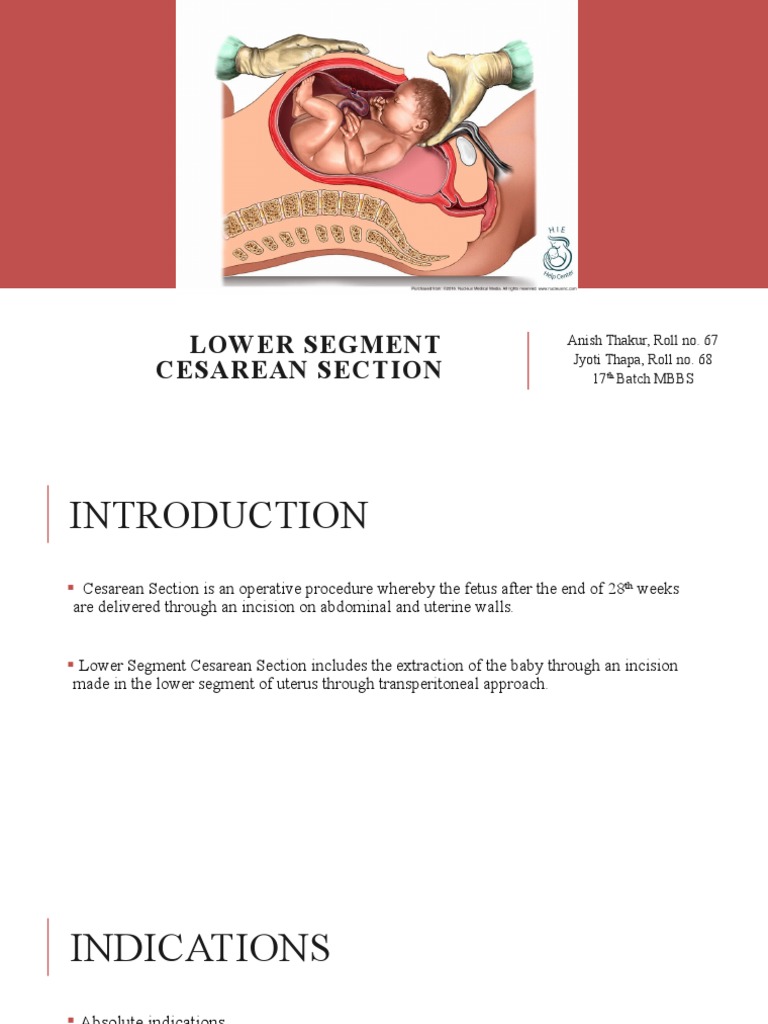 Lower Segment Cesarean Section | PDF | Caesarean Section | Childbirth