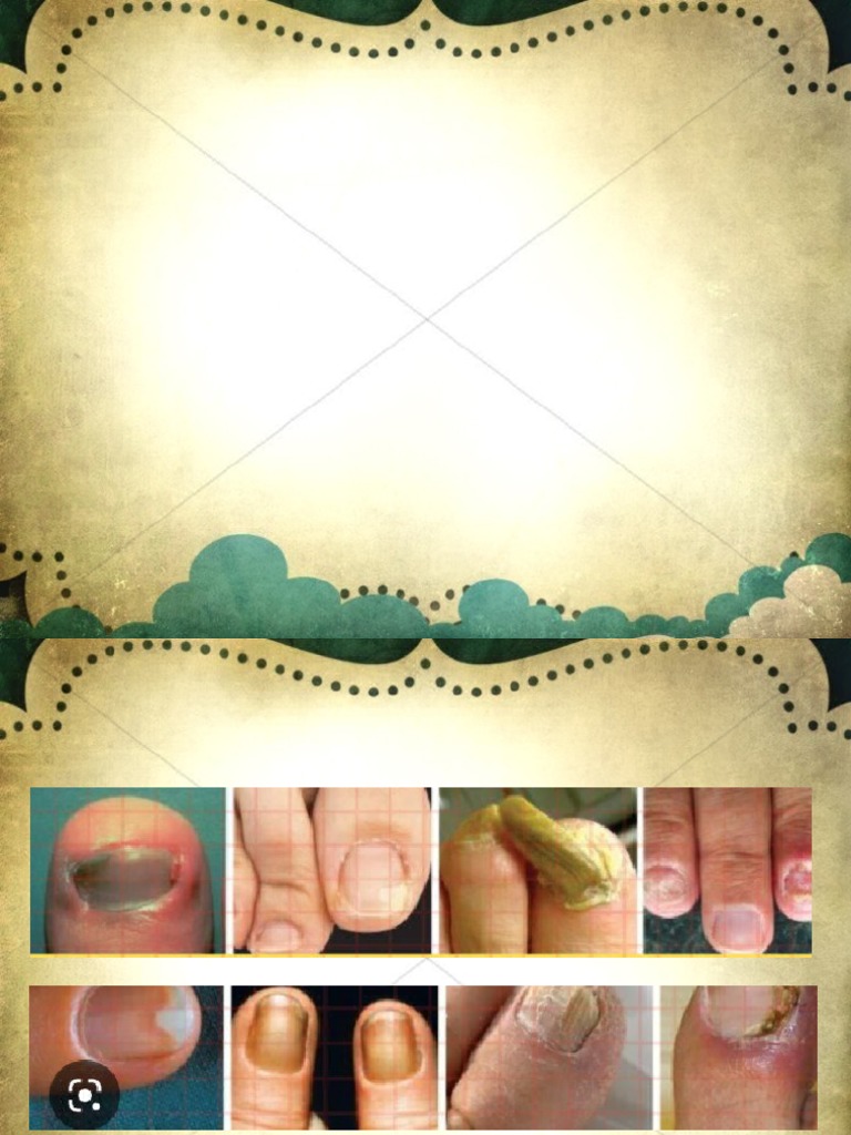 Nail Diseases and Disorders | PDF | Nail (Anatomy) | Cutaneous Conditions