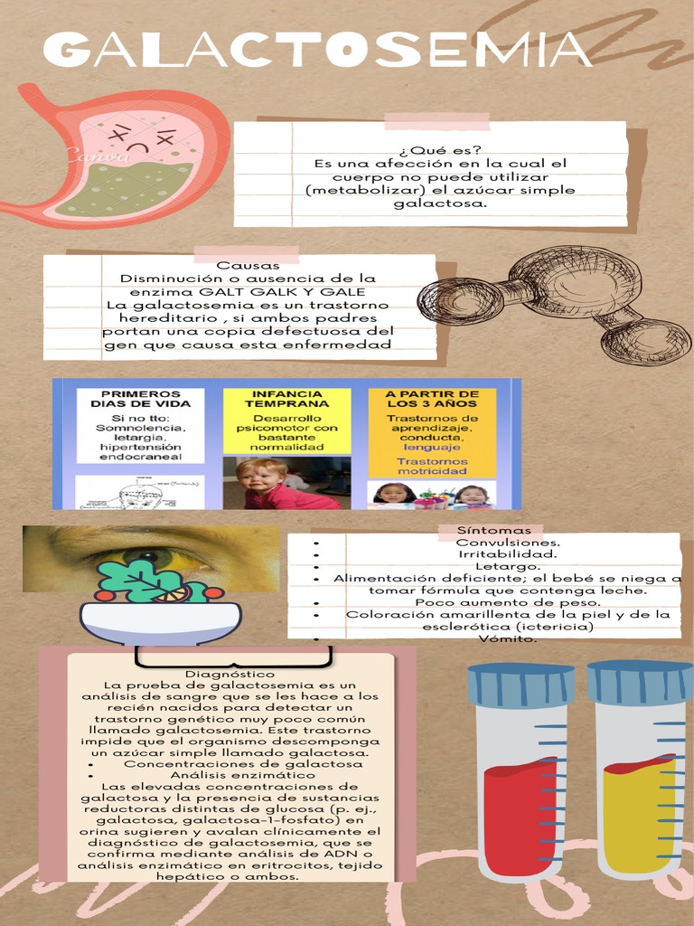 Galactosemia | PDF | Medicina | Causas de la muerte