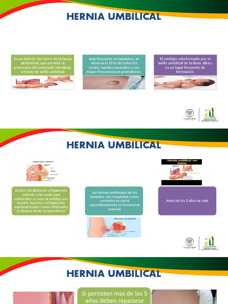 Hernia Umbilical | PDF | Abdomen | Peritoneo