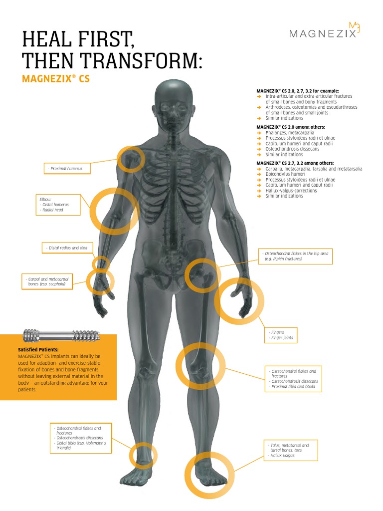 Magnezix CS Brochure For Doctor 01 | PDF | Musculoskeletal System ...