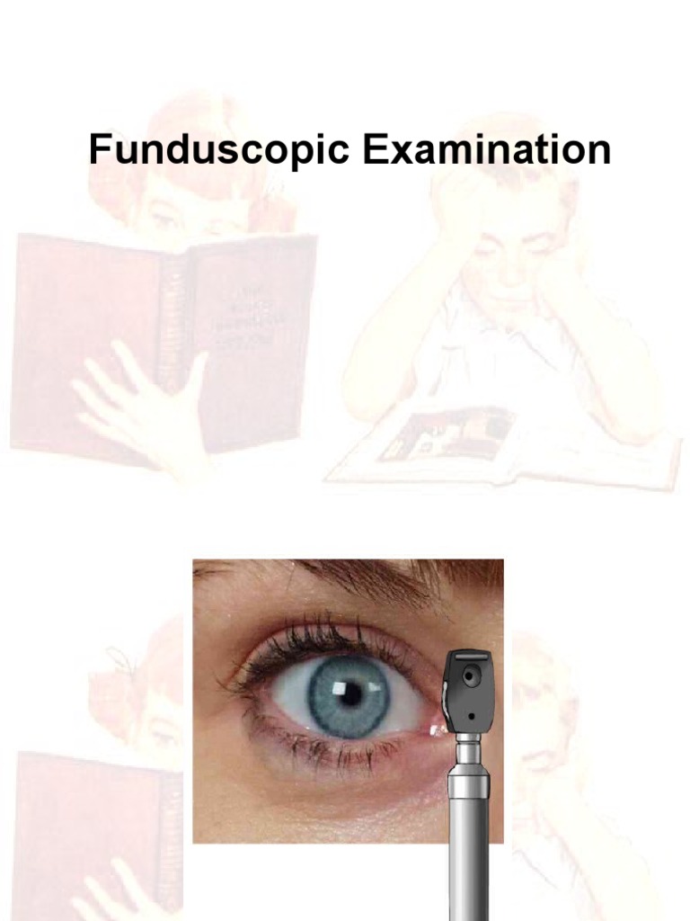 Salin-Funduscopic Examination (1) - RZ | PDF