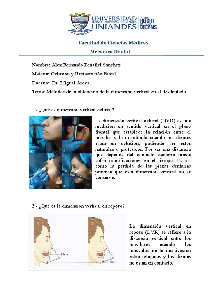 Alex Dimension Vertcal | PDF | Odontología | Cuidado de la salud