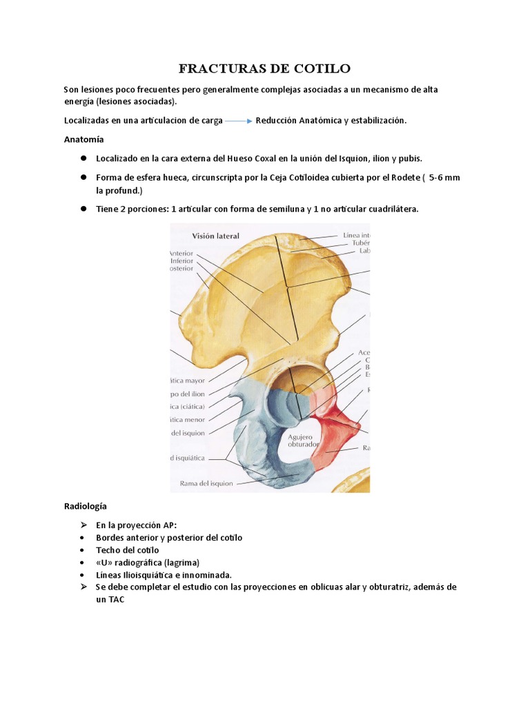 Fracturas de Cotilo: Clasificación y Tratamiento | PDF | Pelvis ...