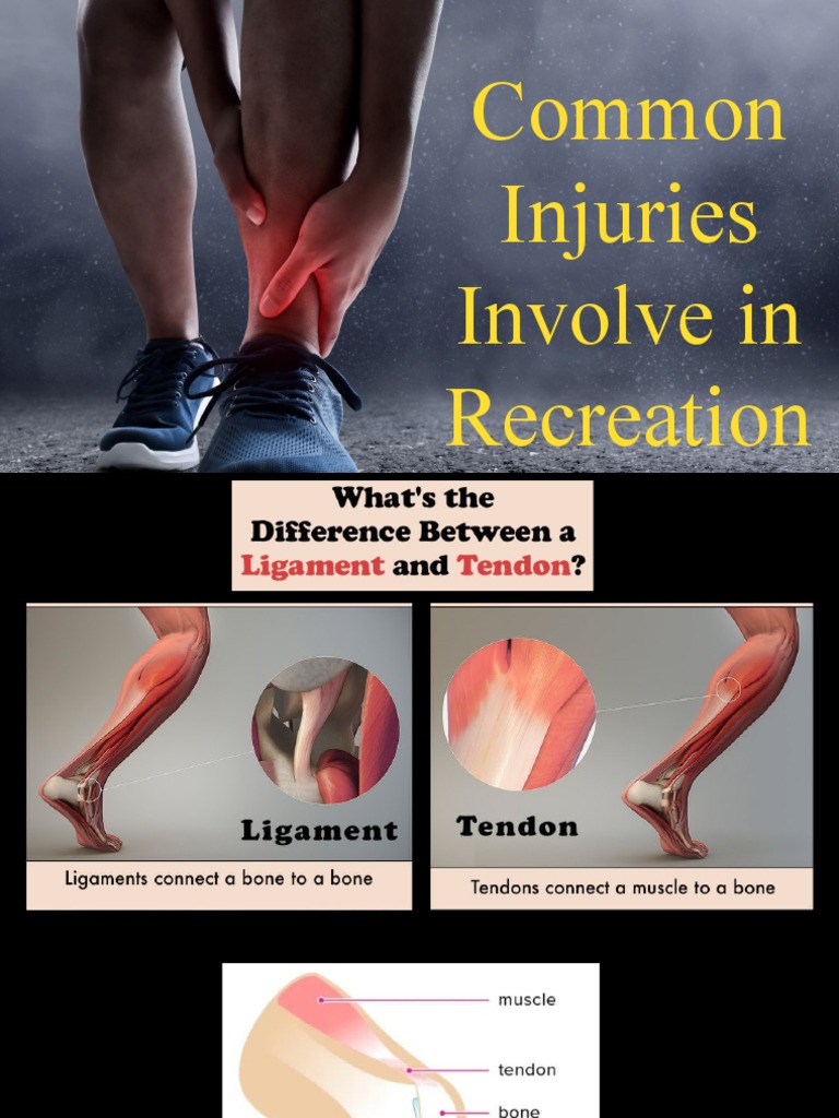 Q4 - PE - Common Injuries Involve in Recreation | PDF Q4 - PE - Common Injuries Involve in Recreation | PDF