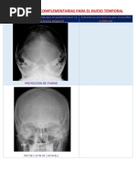 Protocolo Serie Osea o Huesos Largos | PDF | Hueso | Radiología