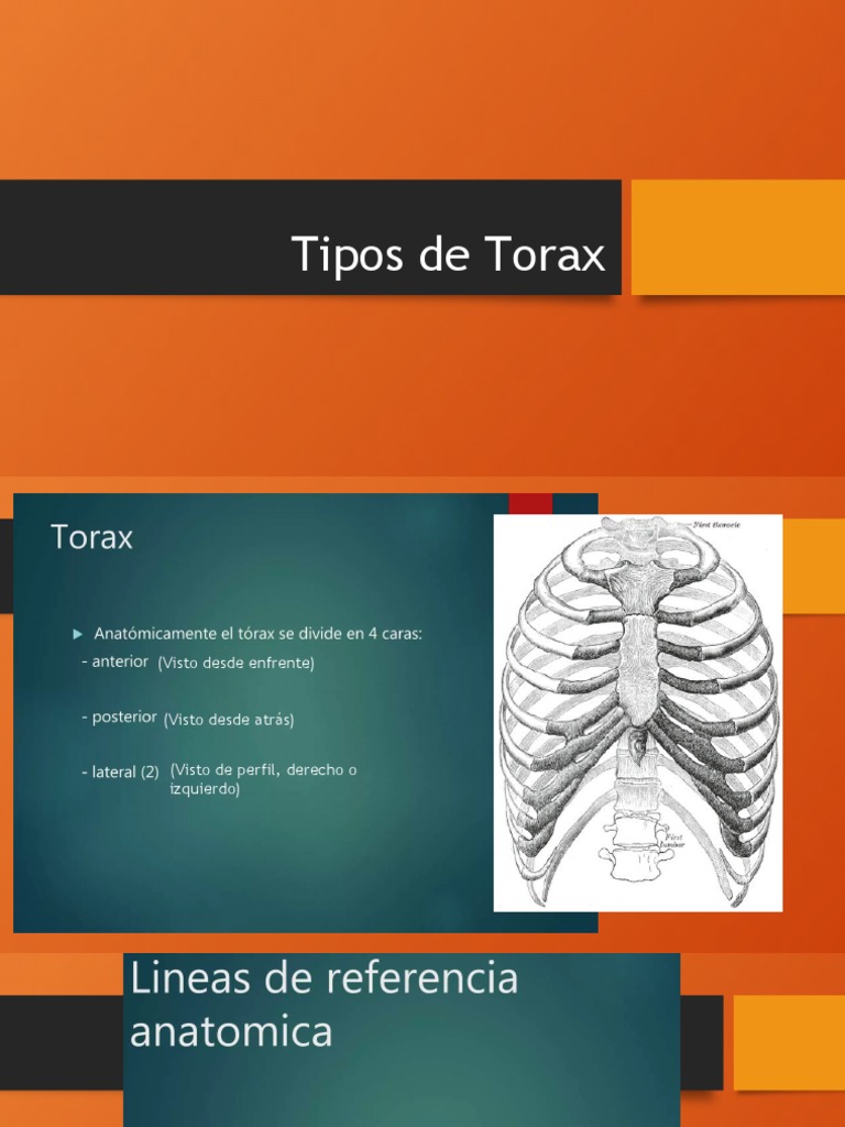 Tipos y Anomalías del Tórax | PDF