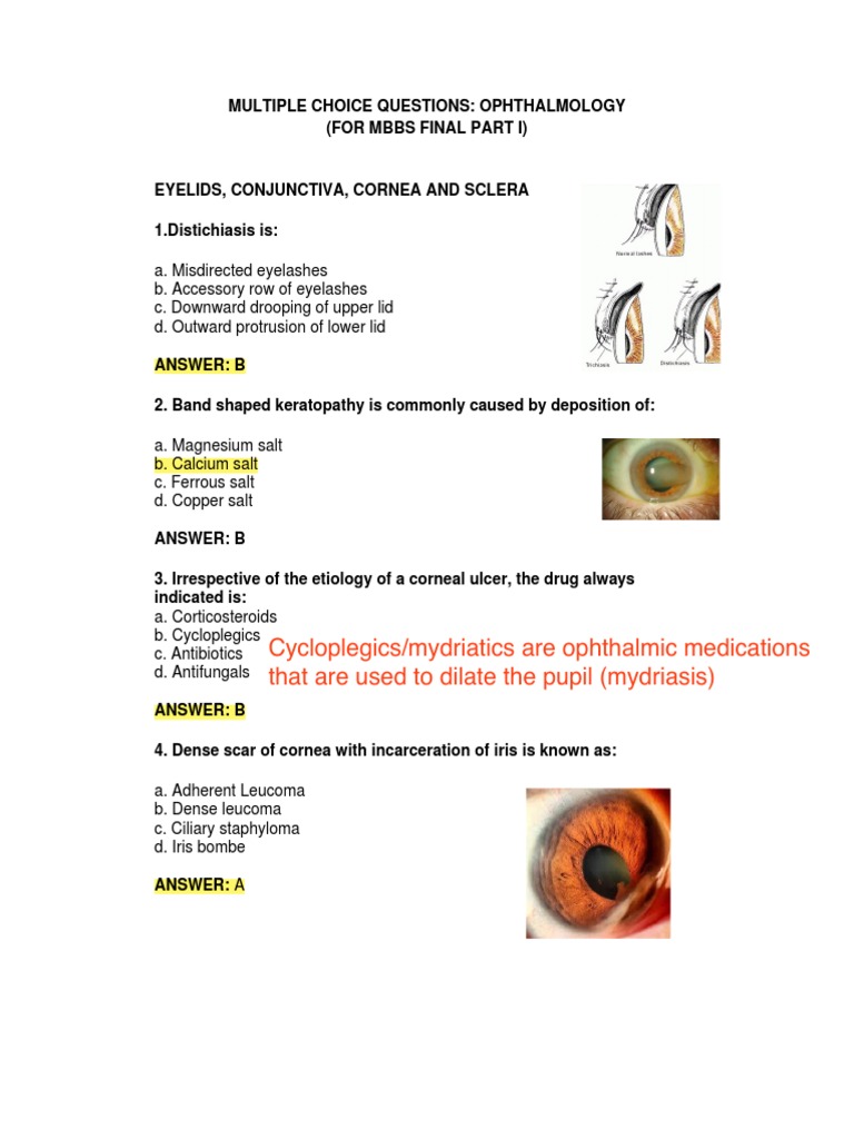 MCQ Opthalmo | PDF | Glaucoma | Retina