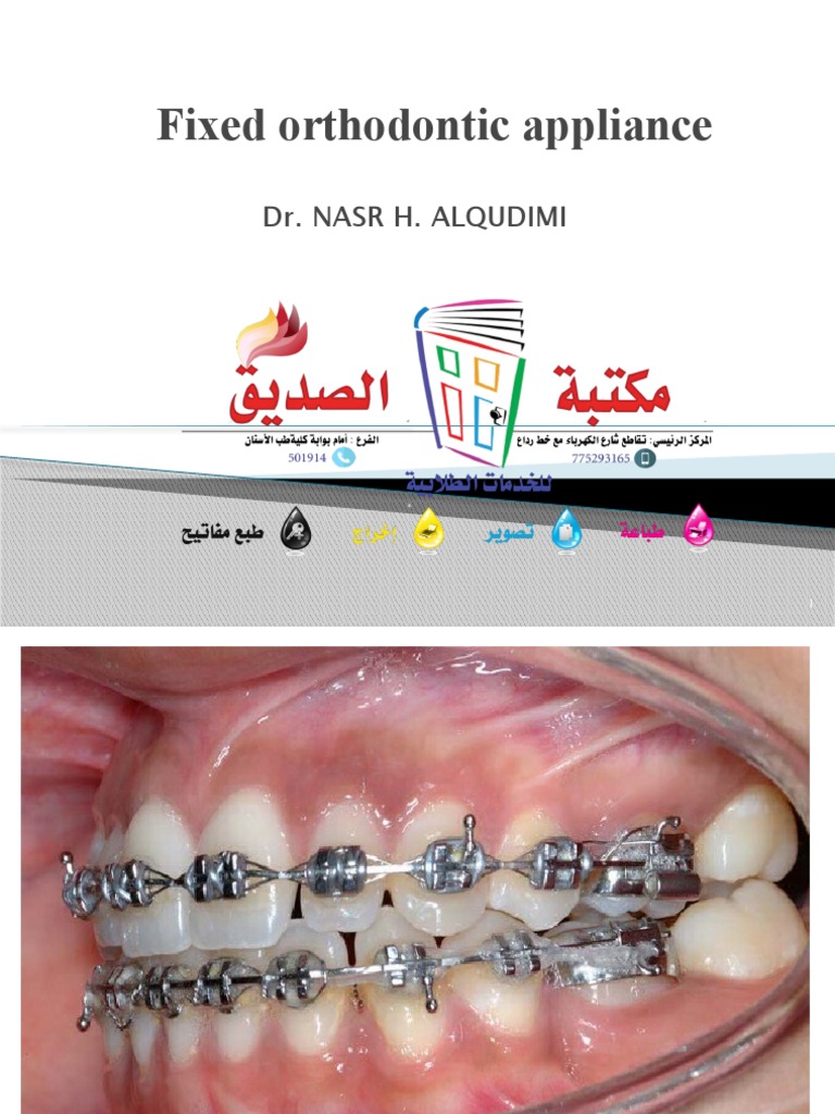 Fixed Ortho. Appliance | PDF | Dentistry Branches