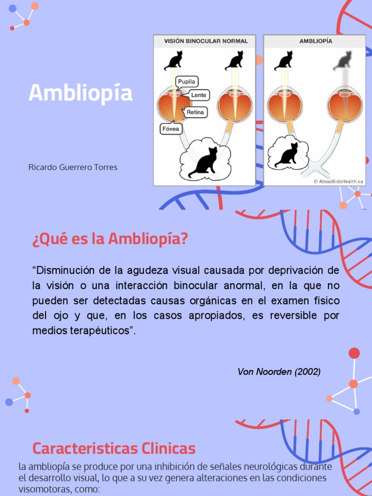 AMBLIOPÍA | PDF | Percepción visual | Causas de la muerte
