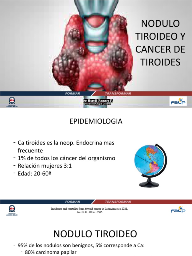 Cancer de Tiroides | PDF | Glándulas | Cáncer